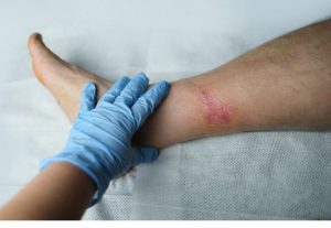 Home Page - Heart & Leg