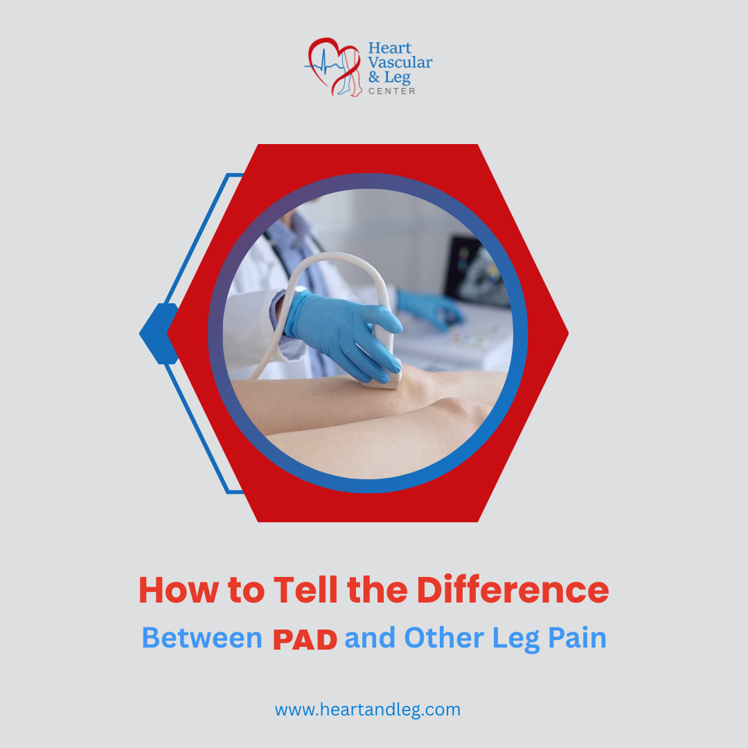 How to Tell the Difference Between PAD and Other Leg Pain