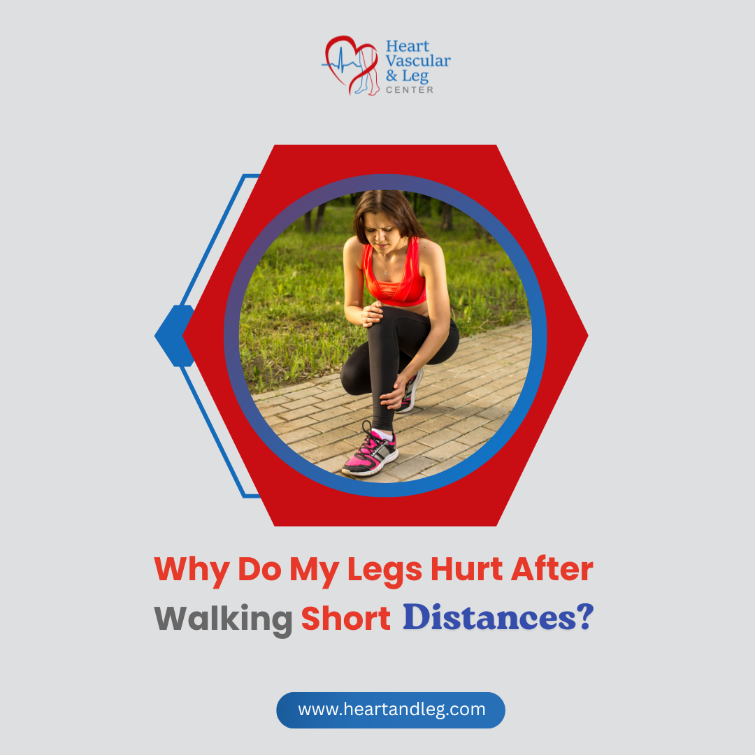 Why Do My Legs Hurt After Walking Short Distances?