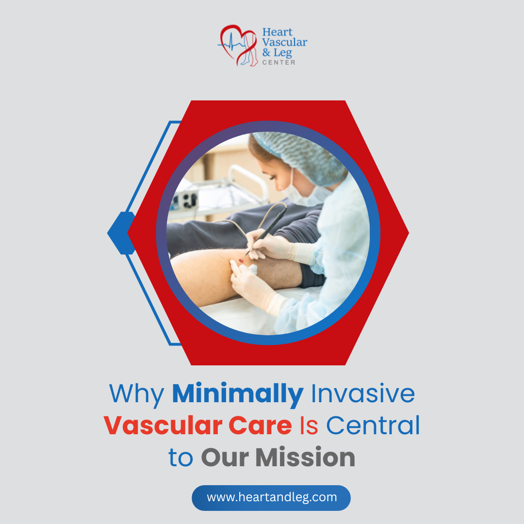 Why Minimally Invasive Vascular Care Is Central to Our Mission