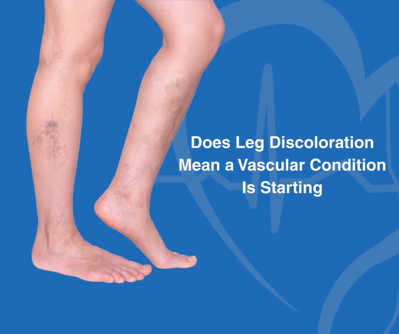 Heart Vascular & Leg Center | Get Expert PAD & Vascular Care